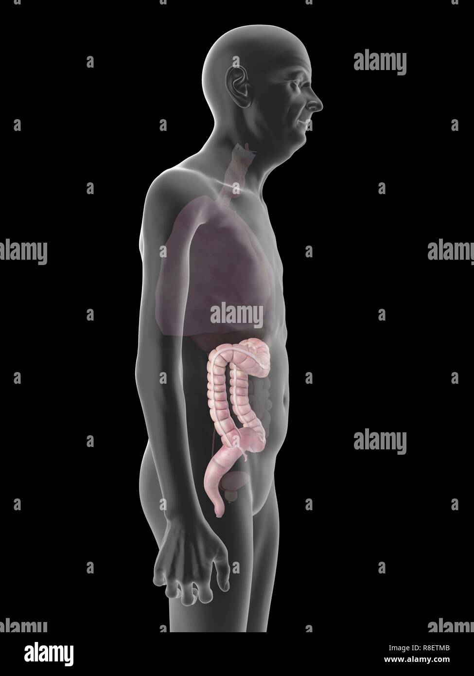 Illustration of an old man's colon Stock Photo - Alamy