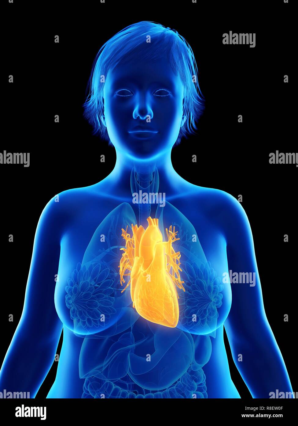 Illustration of an obese woman's heart Stock Photo - Alamy