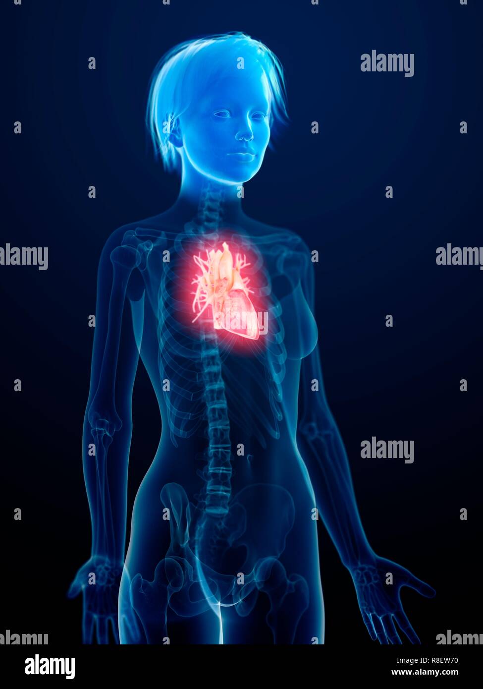 Illustration of an inflamed heart Stock Photo - Alamy