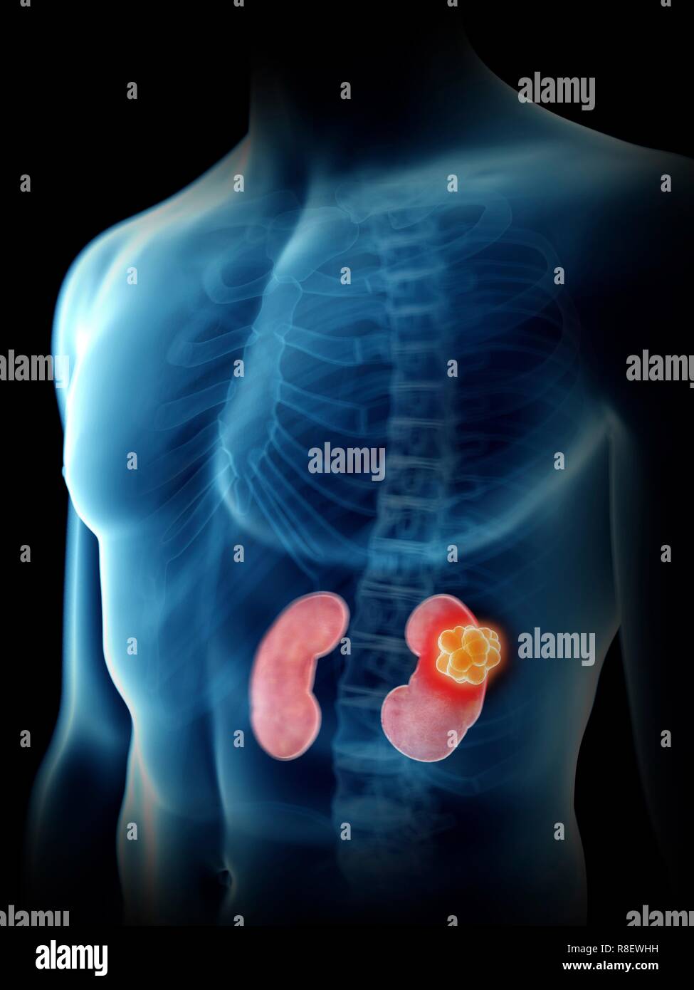 Illustration of a man's kidney Stock Photo - Alamy
