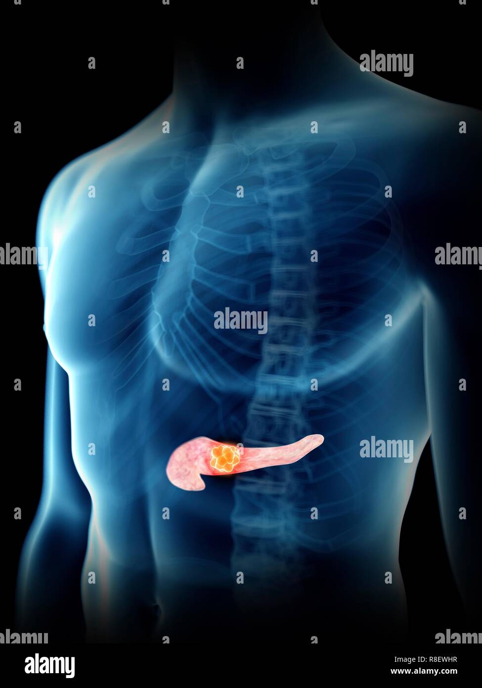 Pancreas diagram hi-res stock photography and images - Alamy