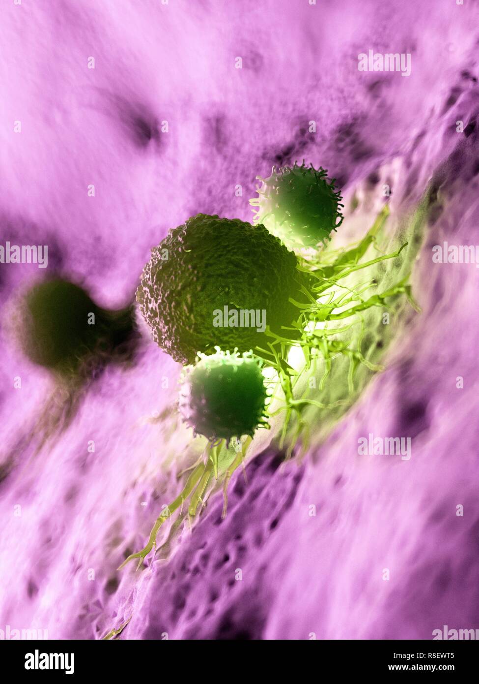 White blood cell attack hi-res stock photography and images - Alamy