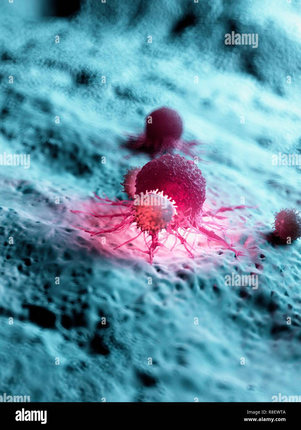 Illustration of a cancer cell being attacked by white blood cells Stock ...