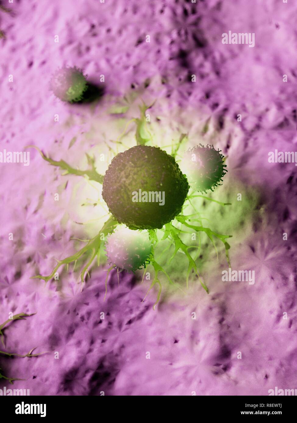 Illustration of a cancer cell being attacked by white blood cells Stock ...