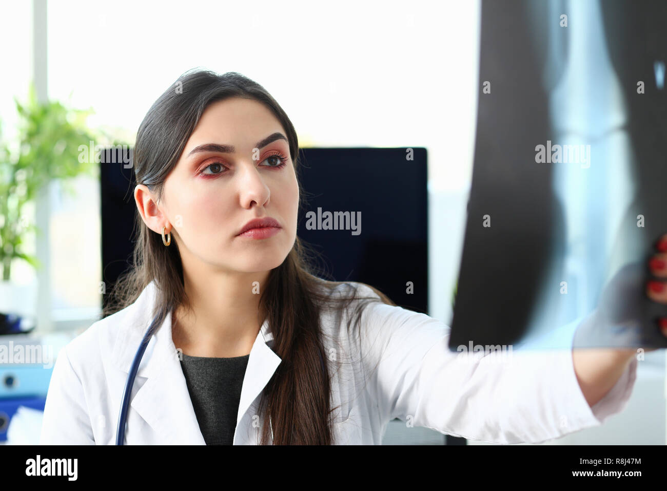 Female beautiful doctor hold in arm and look at xray Stock Photo - Alamy