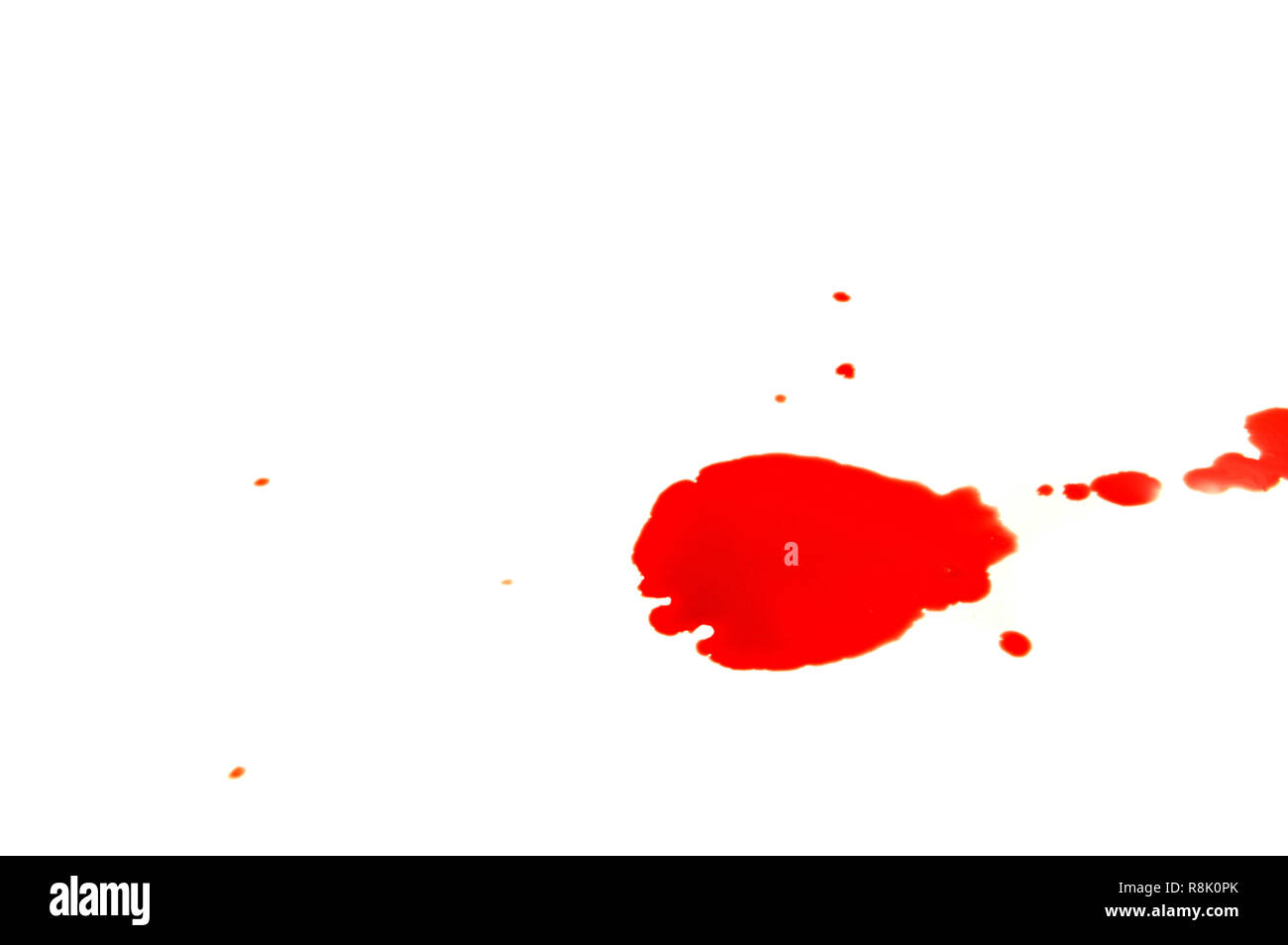 Blood smear High Resolution Stock Photography and Images - Alamy