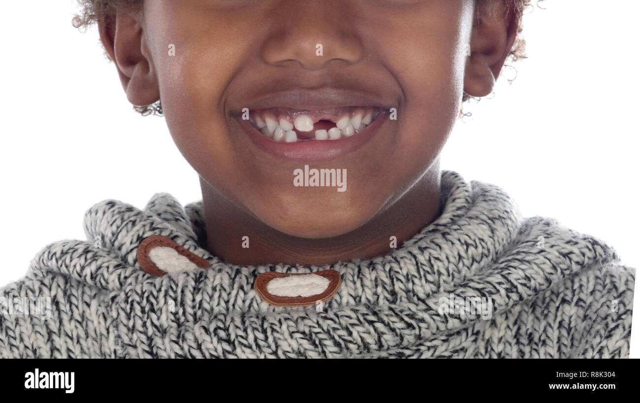 African missing teeth hi-res stock photography and images - Alamy