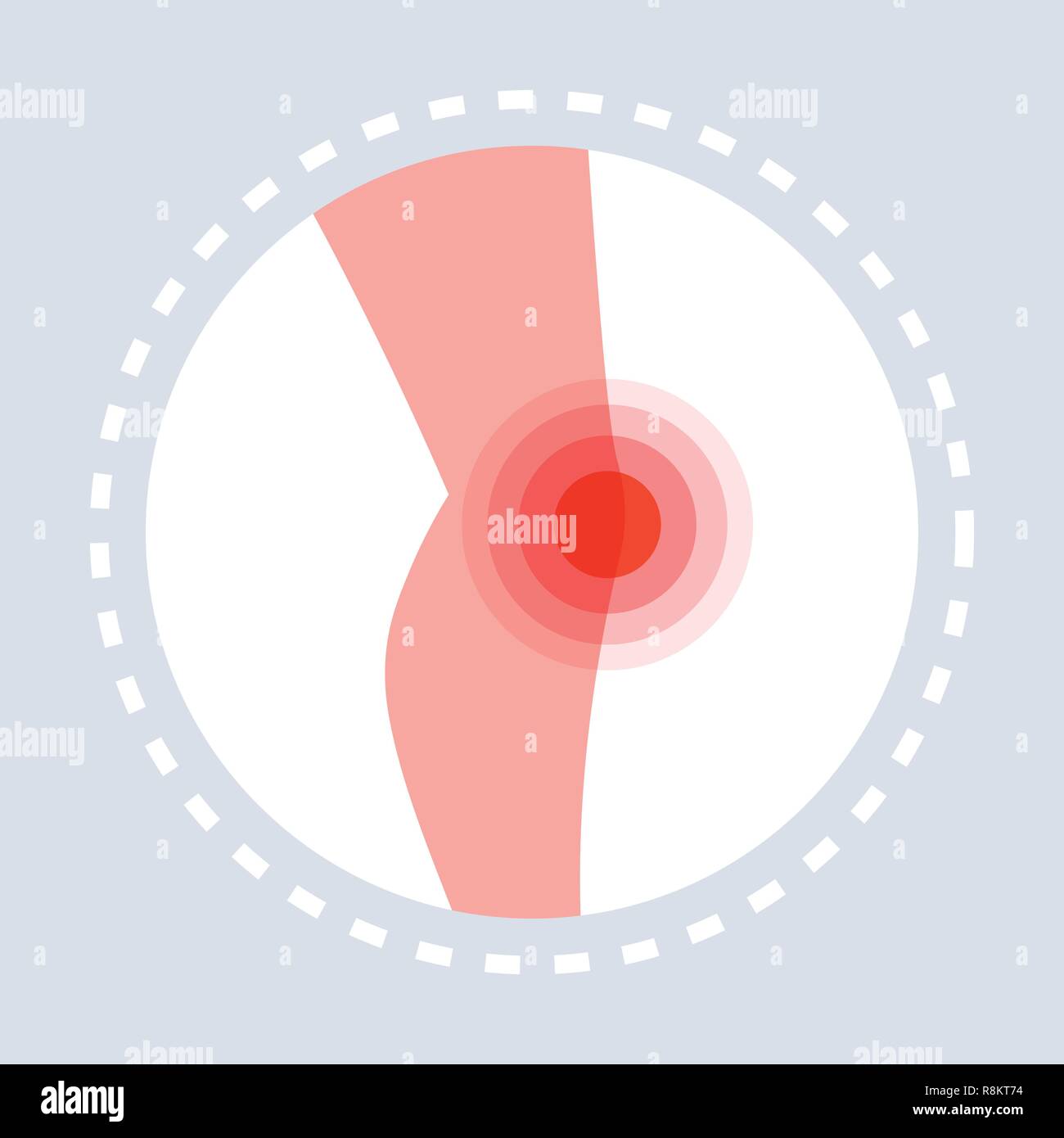 knee injury feeling joint pain human leg icon painful area highlighted ...