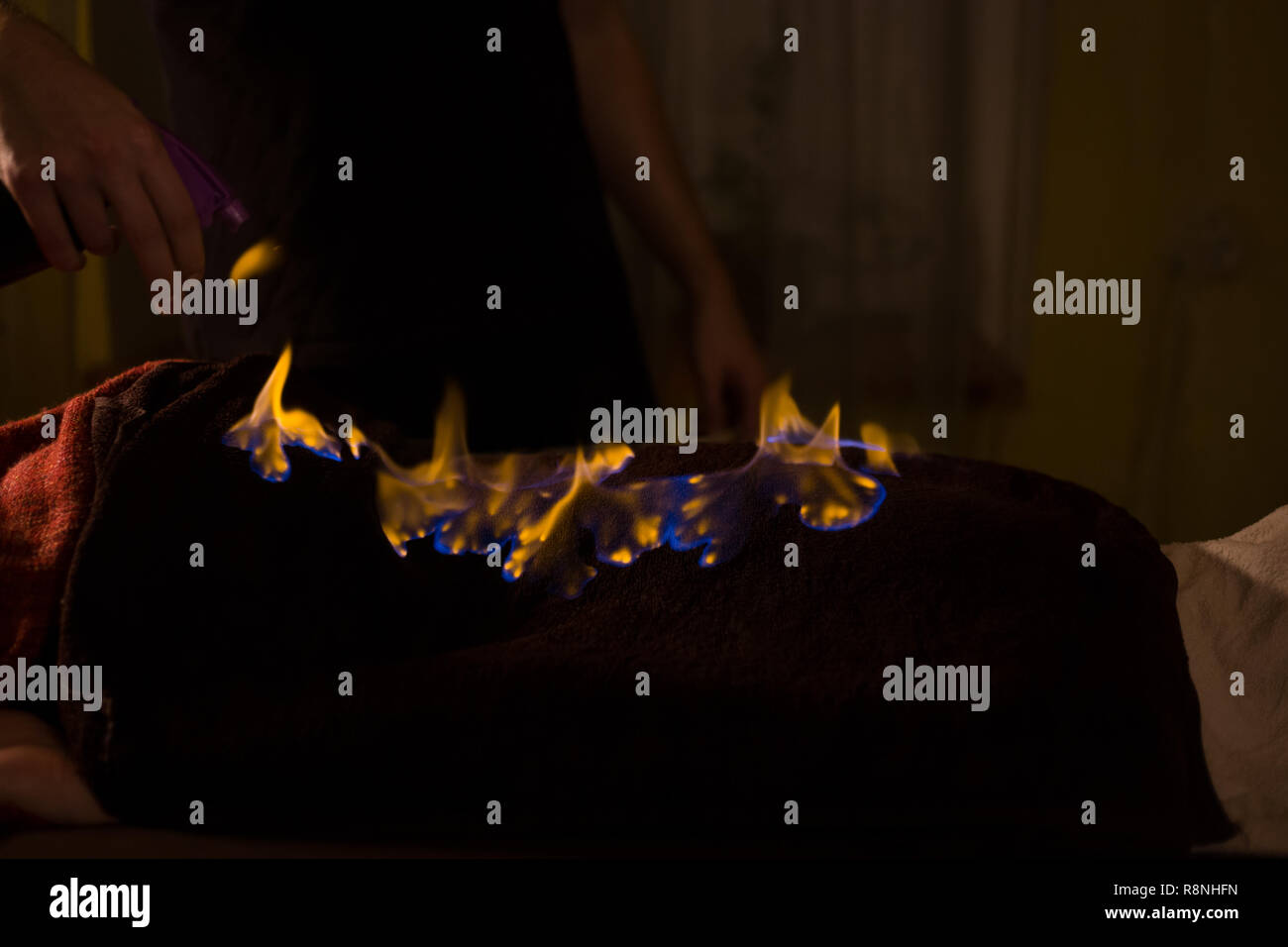 Fire therapy hi-res stock photography and images - Alamy