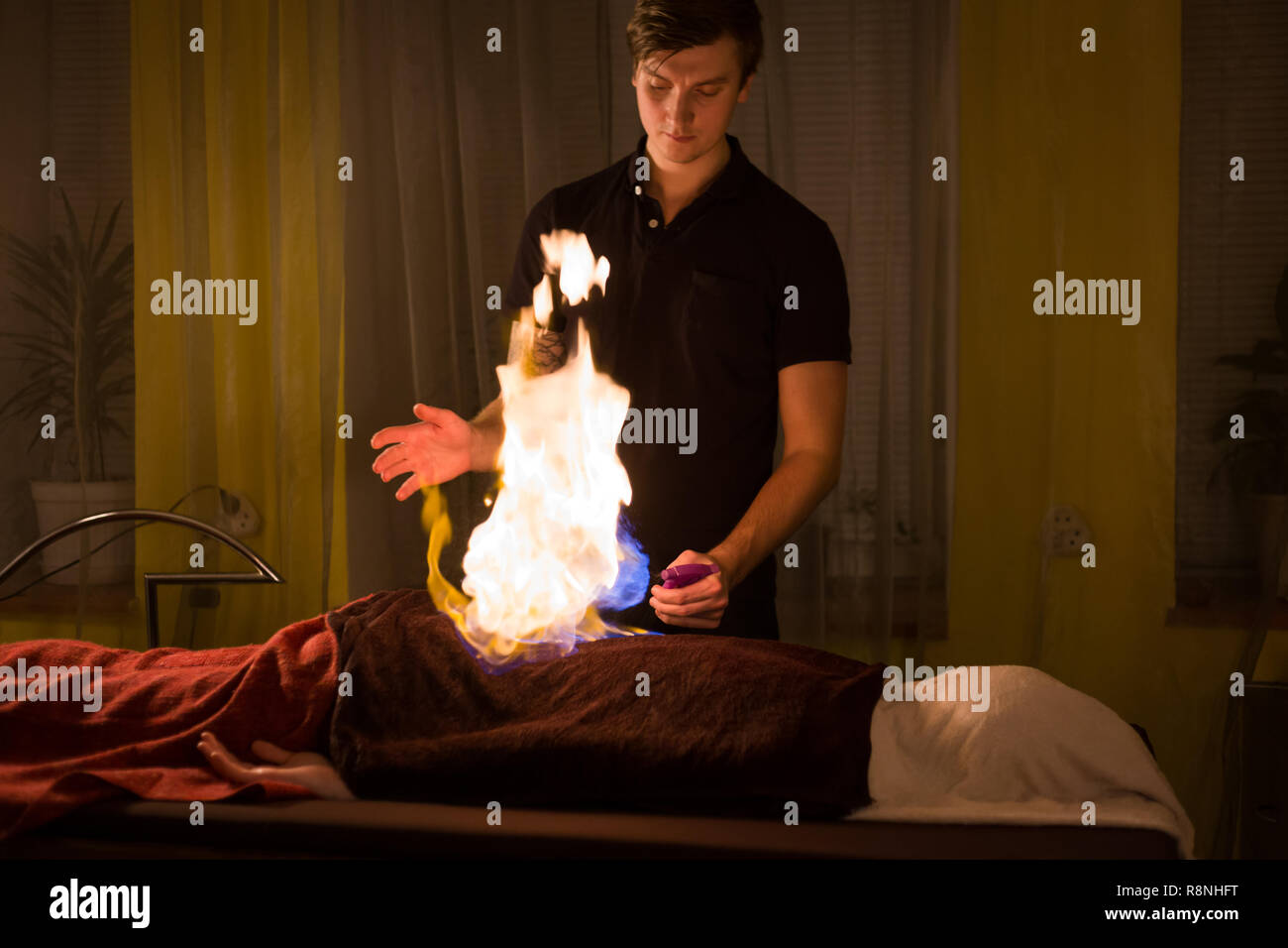 Burn treatment recovery hi-res stock photography and images - Alamy