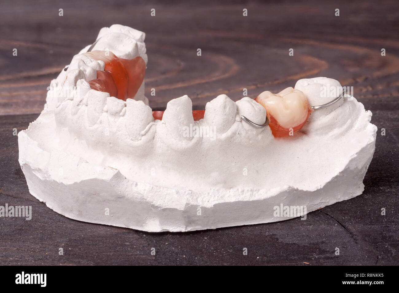 plaster cast of teeth with removable partial denture on a dark wooden ...