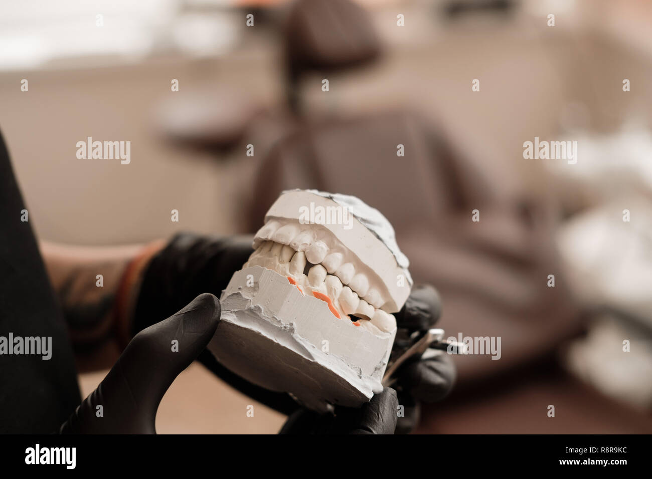 Dental casting gypsum plaster model hi-res stock photography and images ...