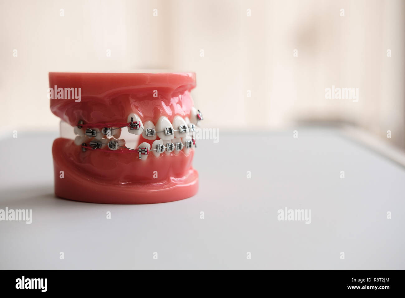 Dental casting model human Jaws with braces in prosthetic laboratory ...