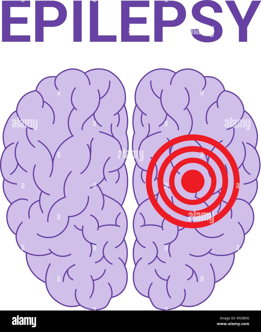 Epilepsy vector icon Stock Vector Image & Art - Alamy