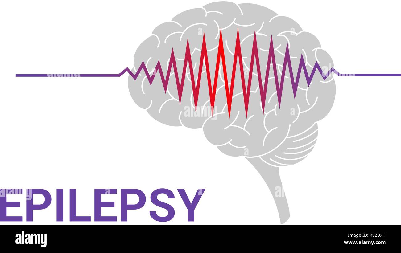 Epilepsy vector icon Stock Vector Image & Art - Alamy
