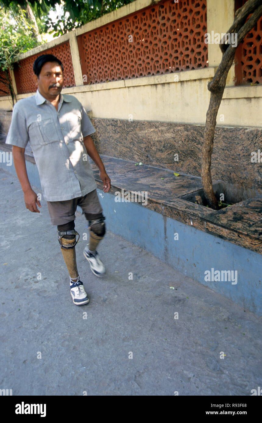 Artificial Jaipur Foot Help the Handicap to walk Stock Photo - Alamy