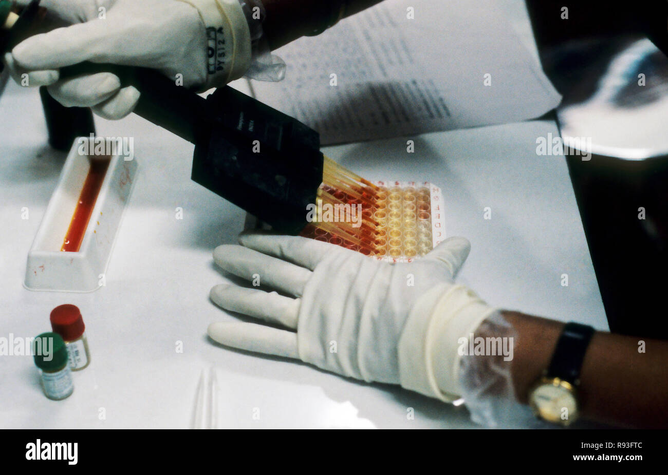 Hiv persons hi-res stock photography and images - Alamy