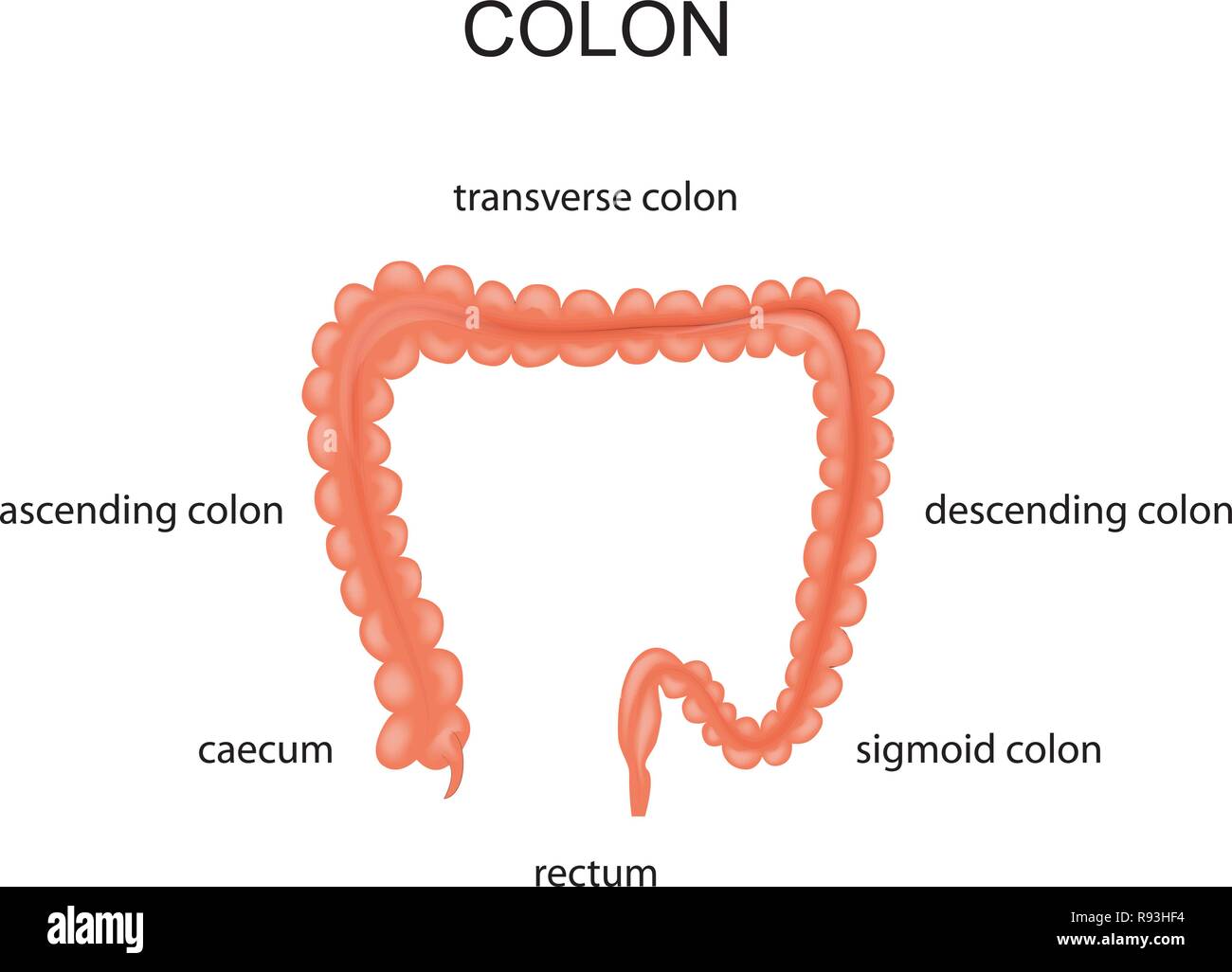Colostomy bag hi-res stock photography and images - Alamy