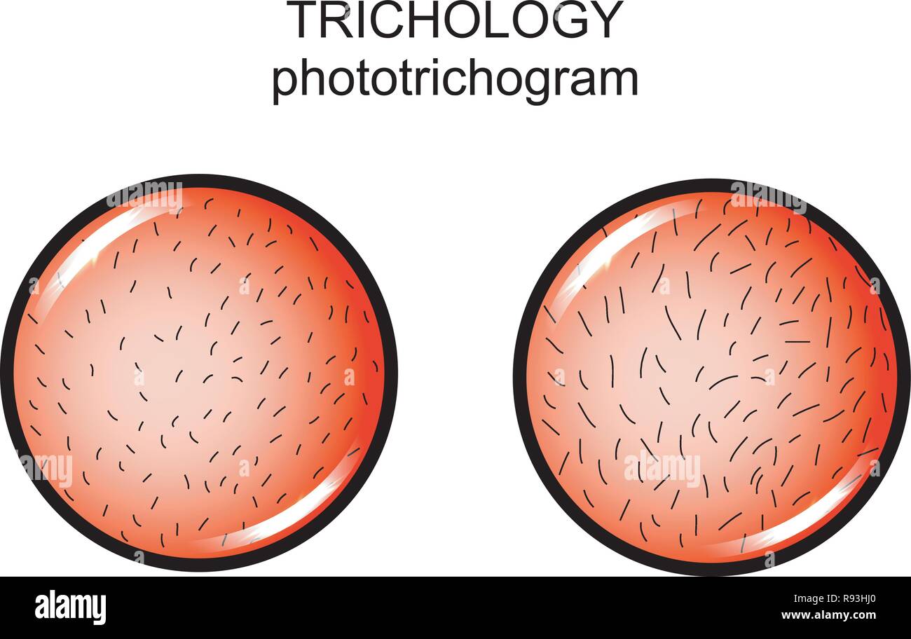 Phototrichogram hi-res stock photography and images - Alamy
