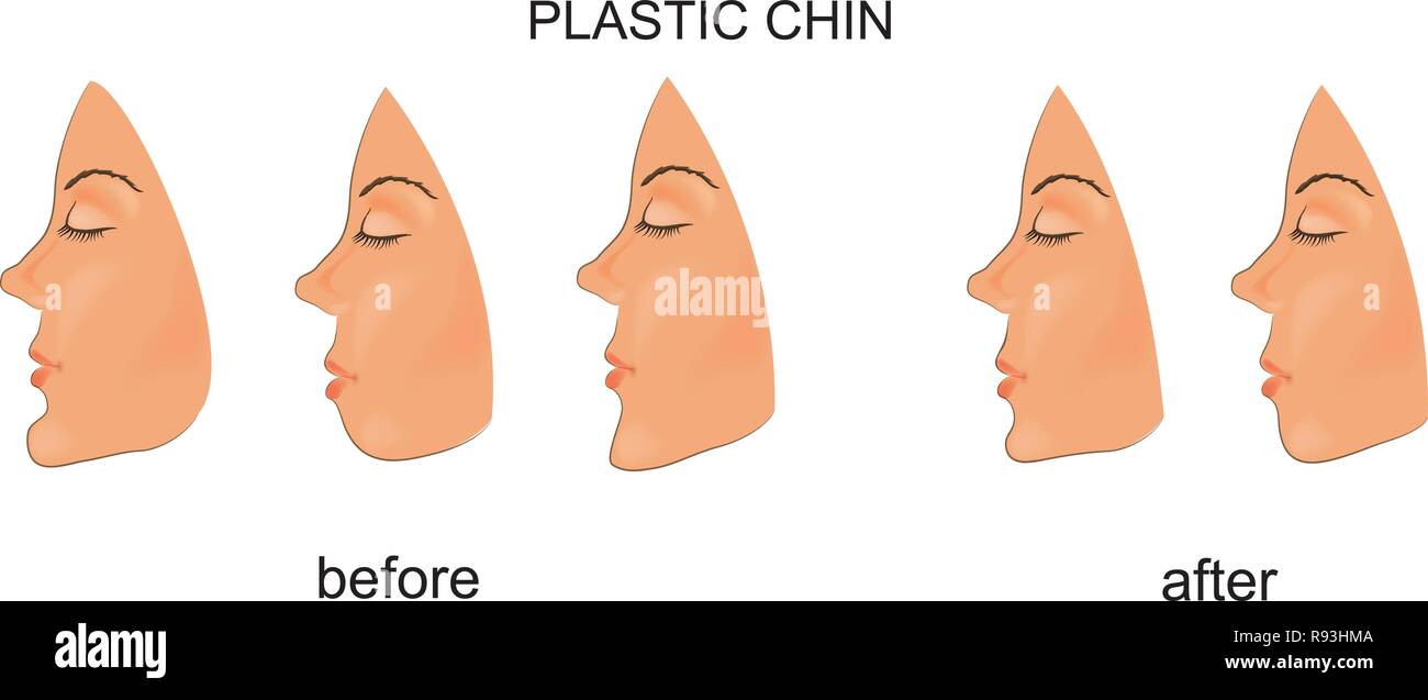 Chin attractive Stock Vector Images - Alamy