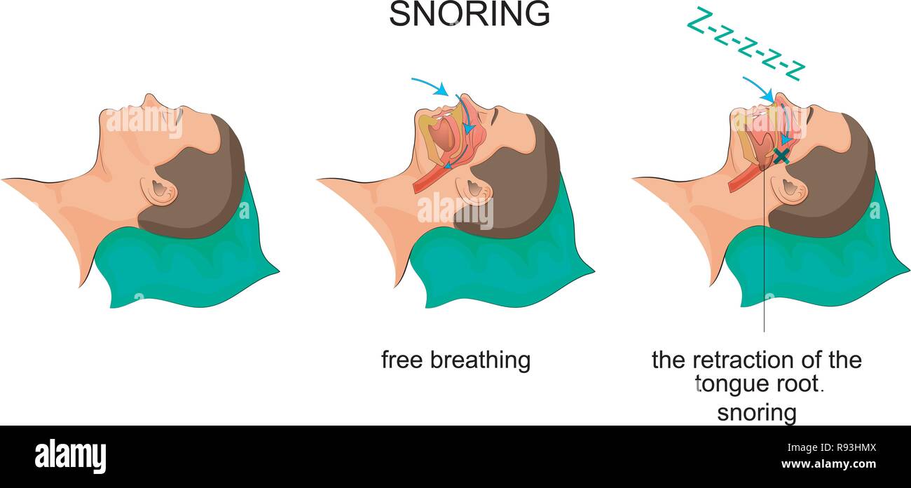 vector illustration of a snoring sleeping man Stock Vector Image & Art ...