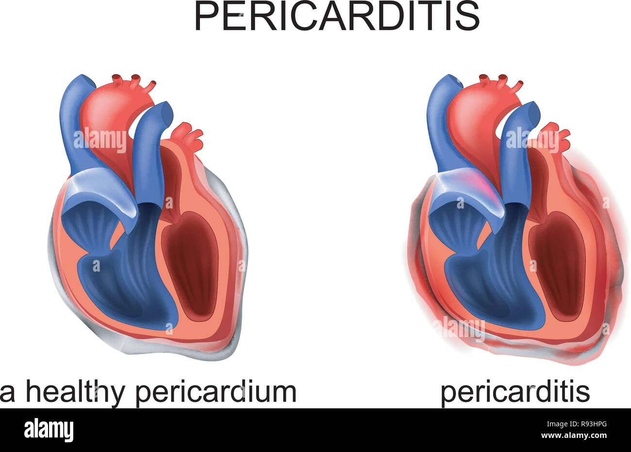 Pericardium hi-res stock photography and images - Alamy