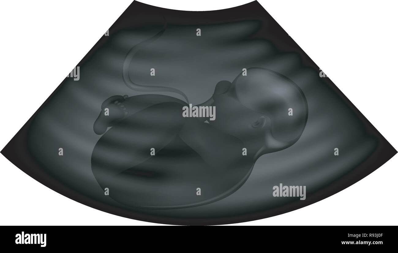 vector illustration of fetal ultrasound. gynecology and obstetrics ...
