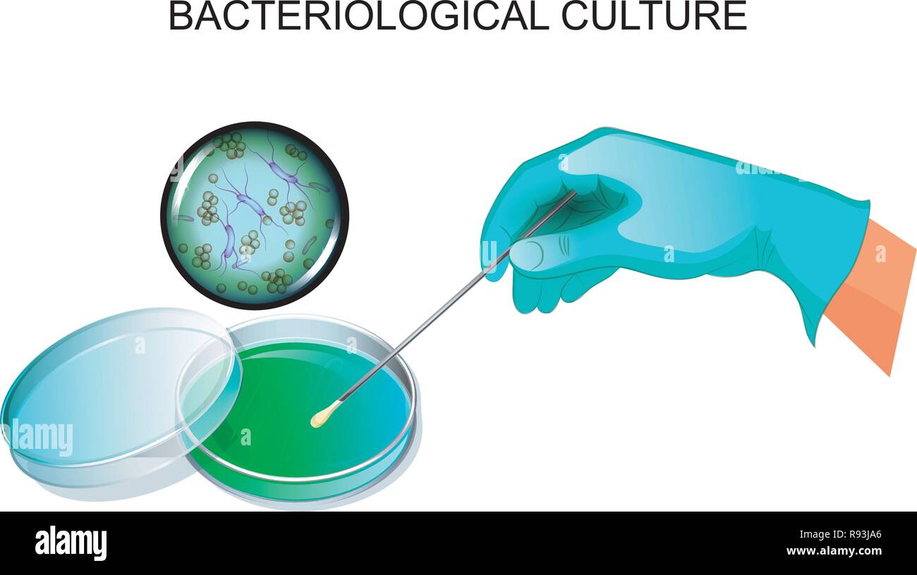 vector illustration of bacterial inoculation in the laboratory Stock ...