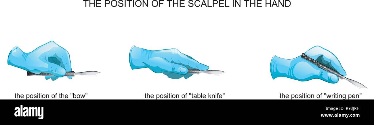 vector illustration of the position of the scalpel in the hand Stock ...