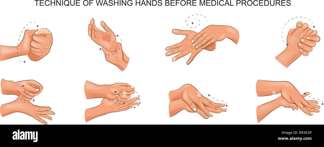 vector illustration of washing hands before medical procedures Stock ...