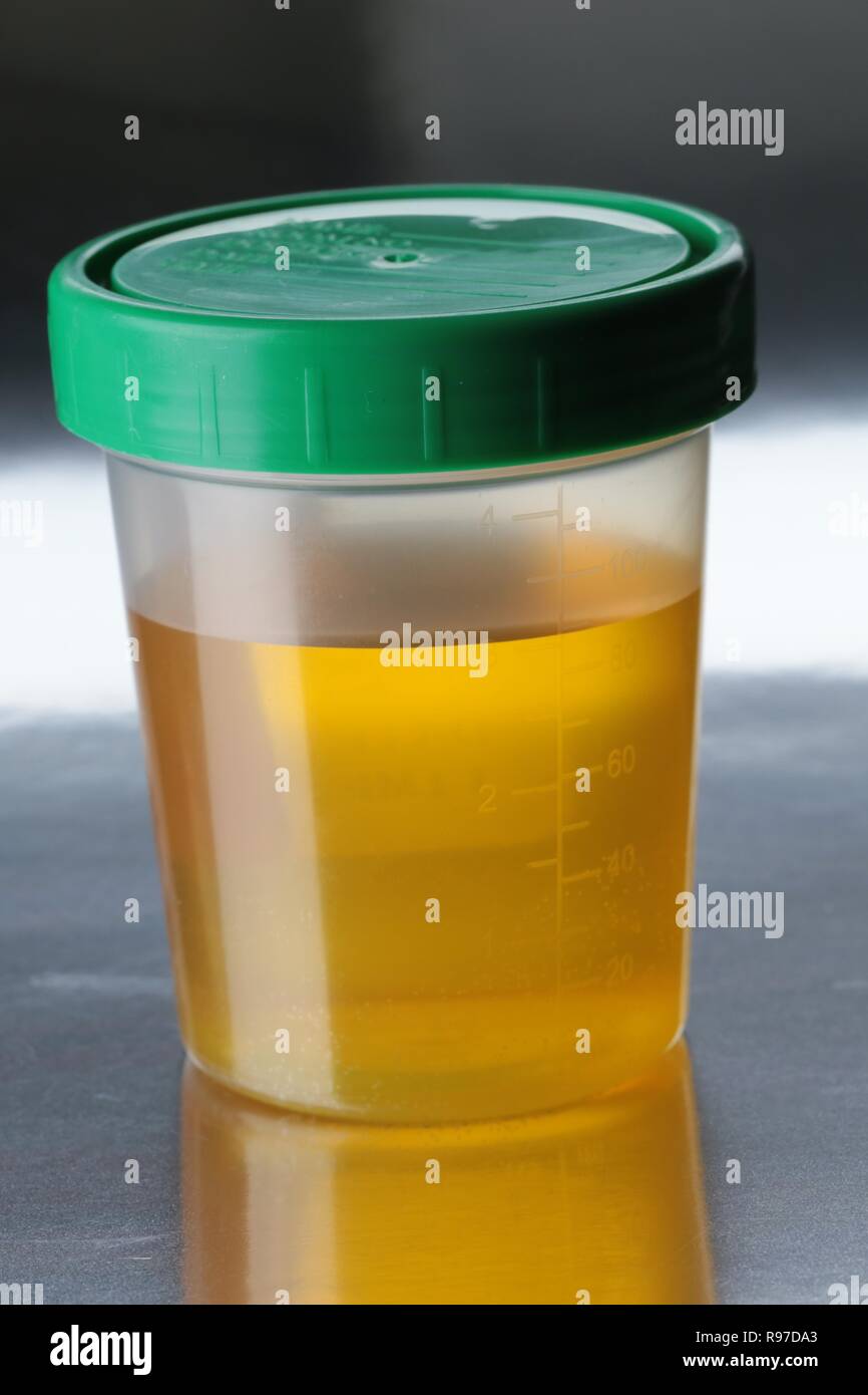 Urine sample in a sealed container Stock Photo - Alamy