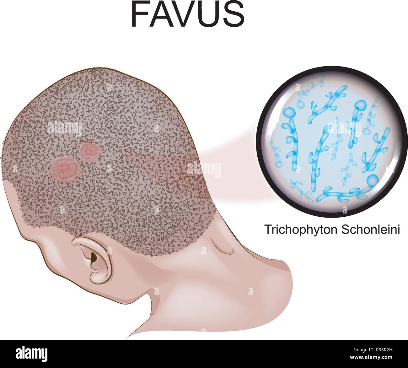 Skin crease Stock Vector Images - Alamy