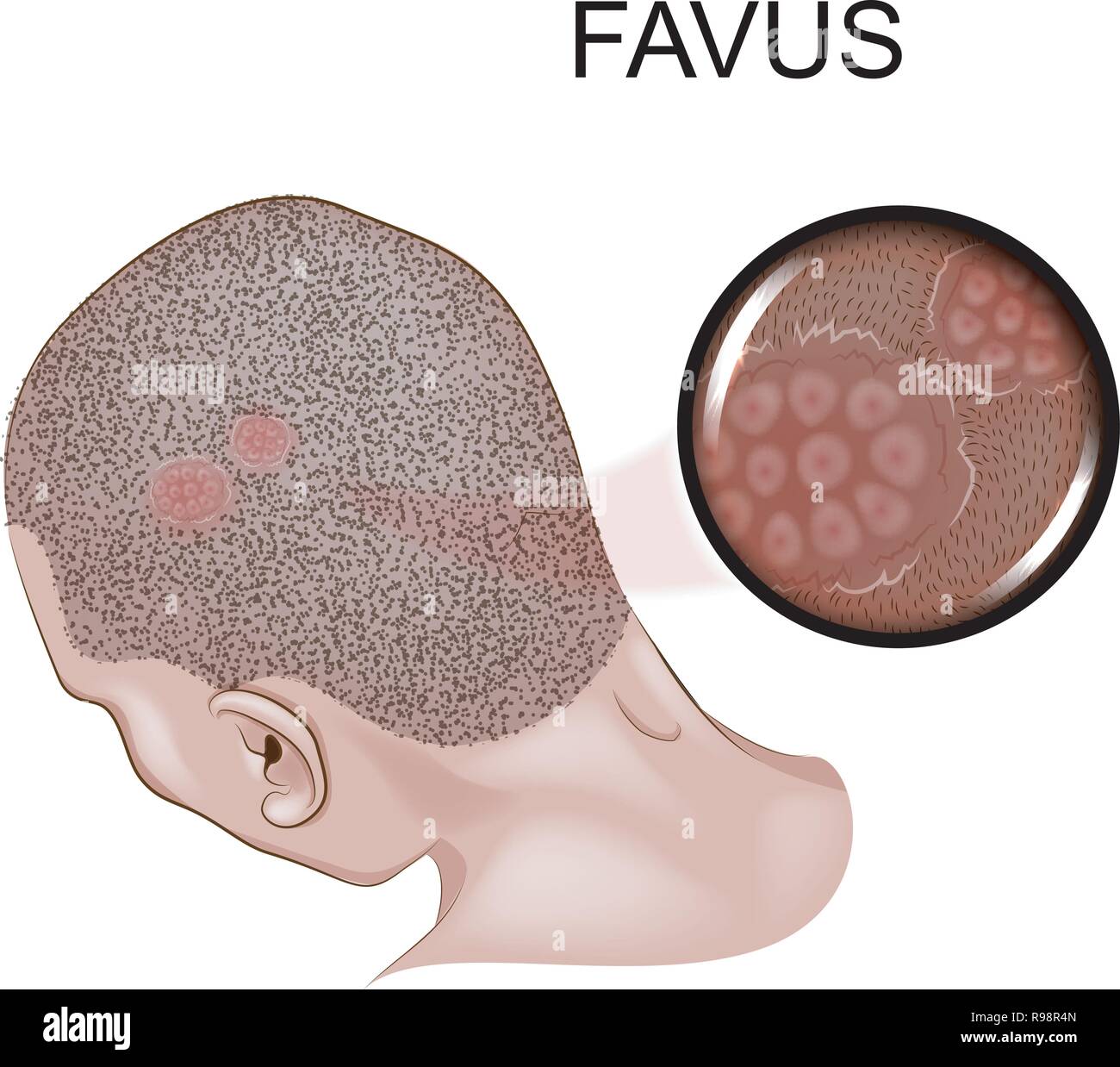 Skin crease Stock Vector Images - Alamy