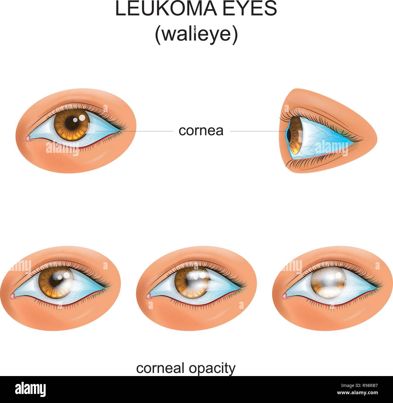 Albugo hi-res stock photography and images - Alamy