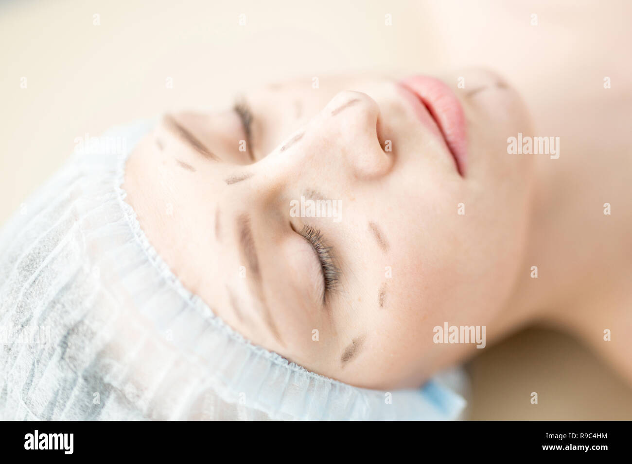Lifting of face Stock Photo - Alamy