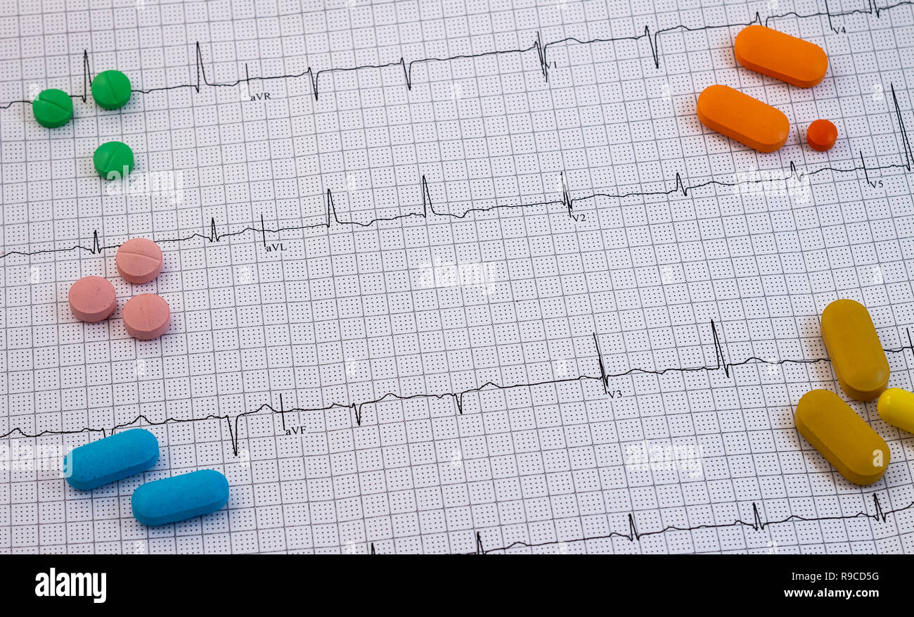 Atrial fibrillation electrocardiogram hi-res stock photography and ...