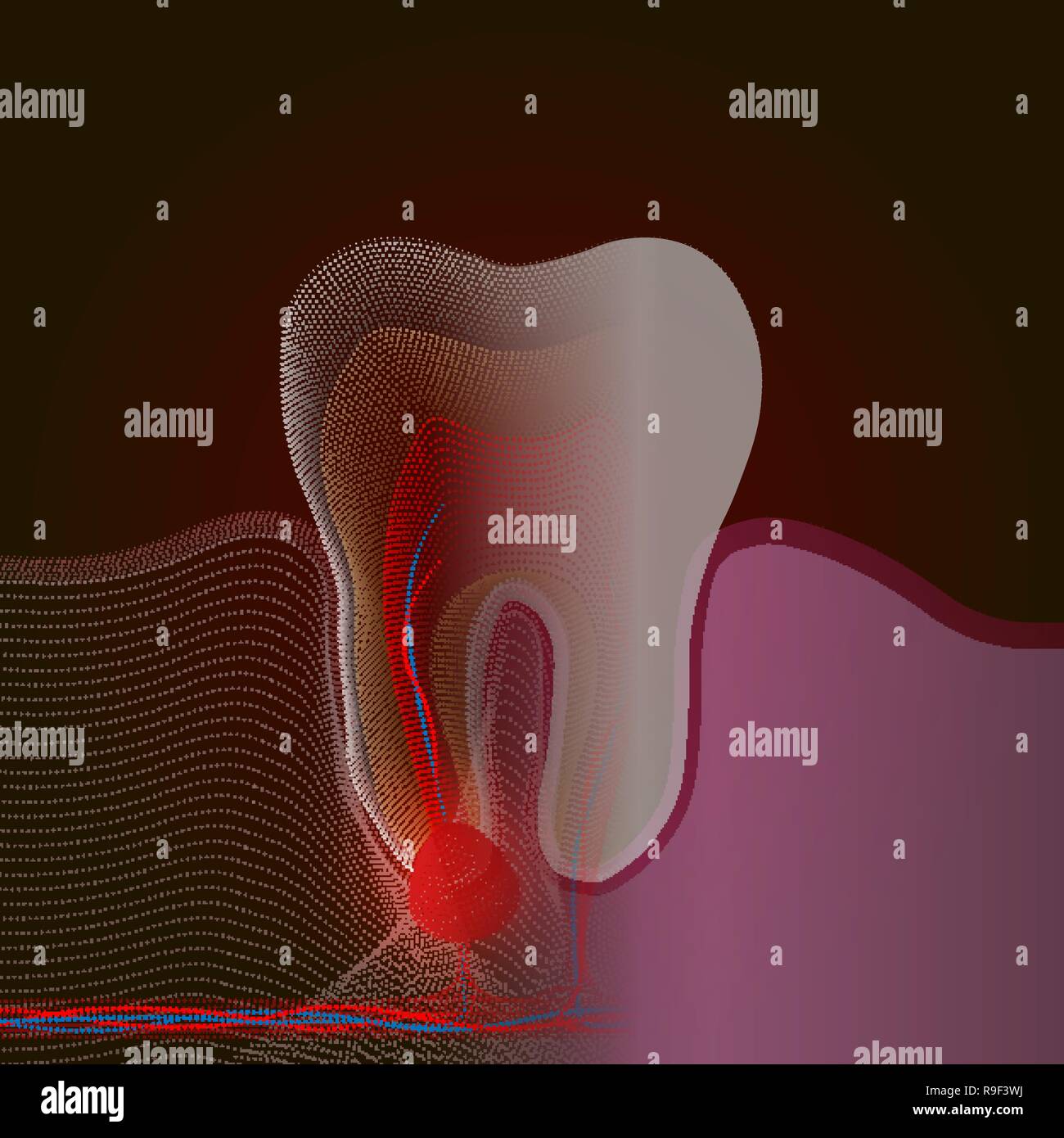 The transition from a real tooth to a point X-ray effect with a point ...