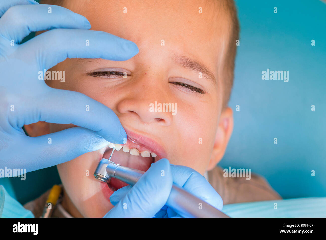 Dentist is treating a boy's teeth Stock Photo - Alamy