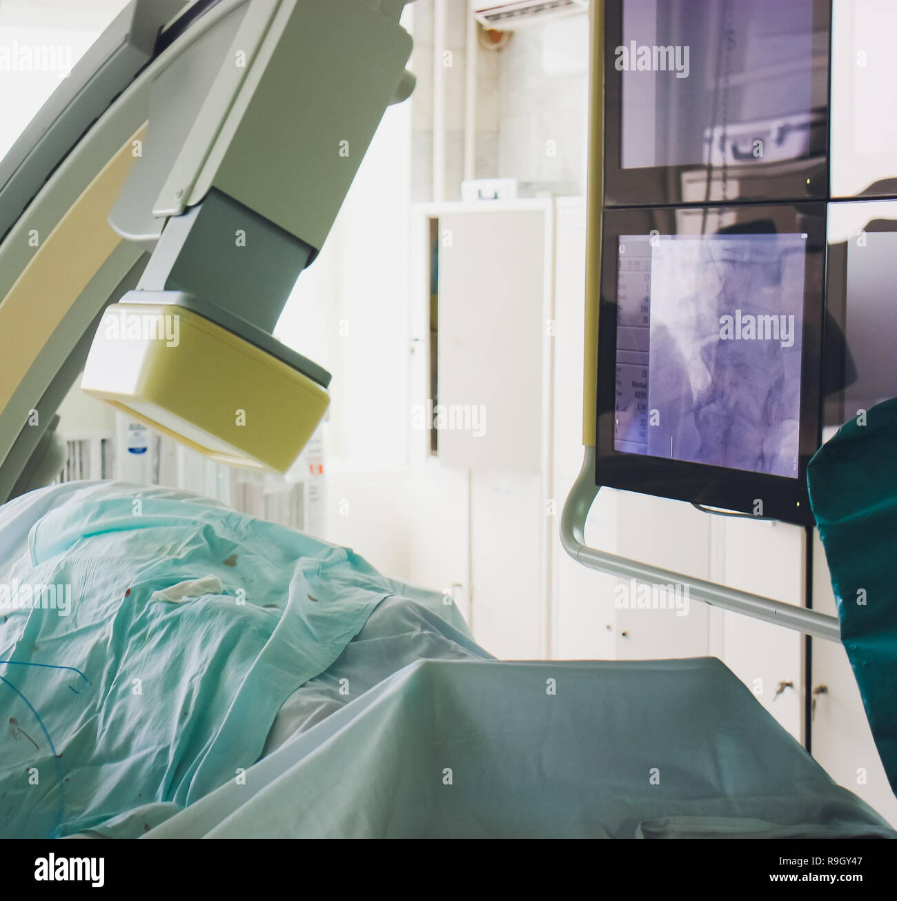 Man with x ray eyes hi-res stock photography and images - Alamy