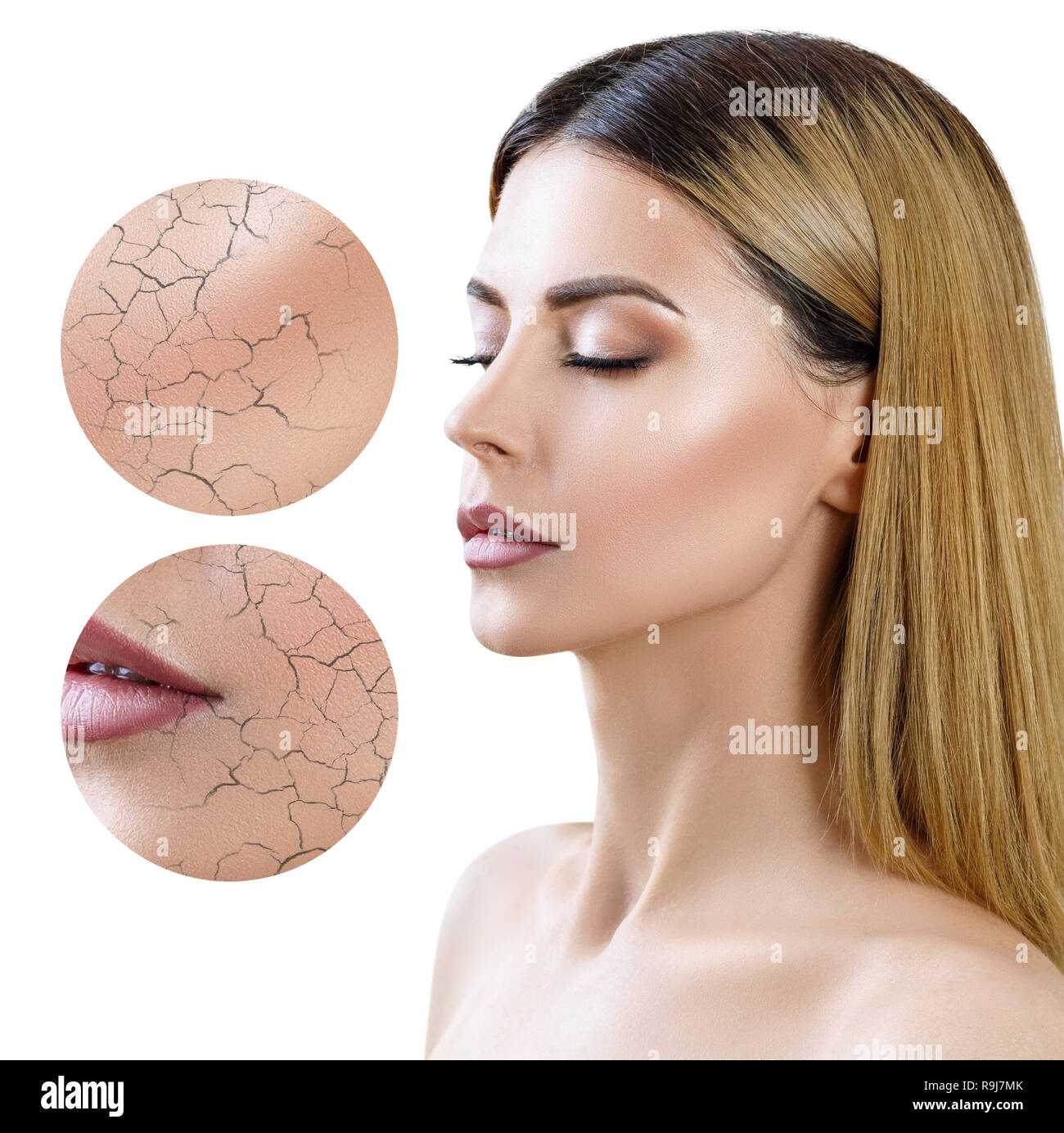 Zoom circle shows dry facial skin before moistening Stock Photo - Alamy