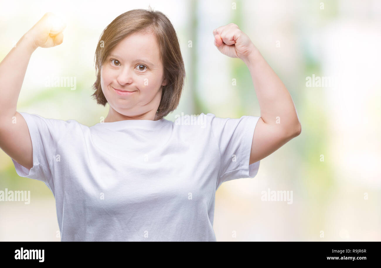 Young adult woman with down syndrome over isolated background showing ...