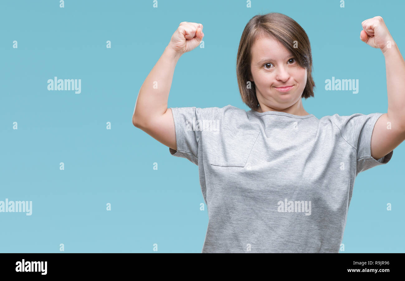 Young adult woman with down syndrome over isolated background showing ...