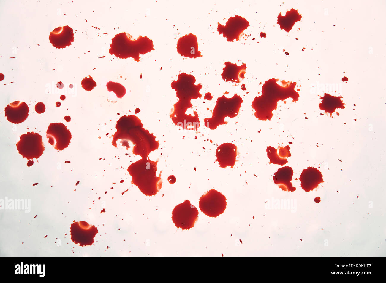 Blood passage hi-res stock photography and images - Alamy