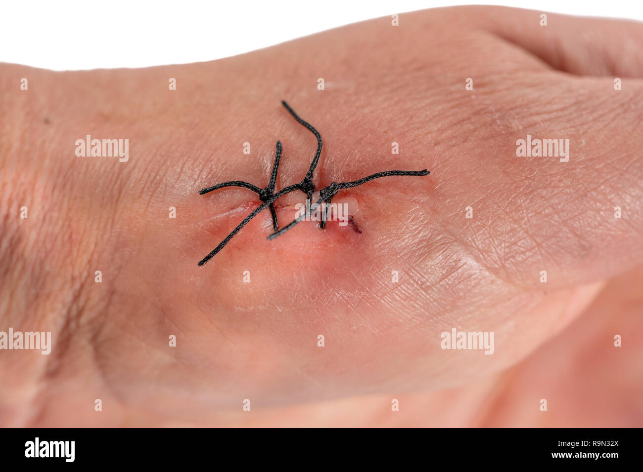 Left hand injury hi-res stock photography and images - Alamy