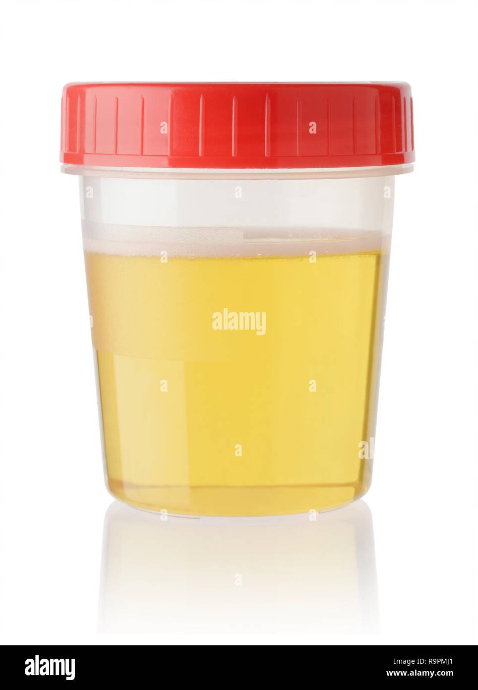Urine sample in container isolated on white background Stock Photo - Alamy