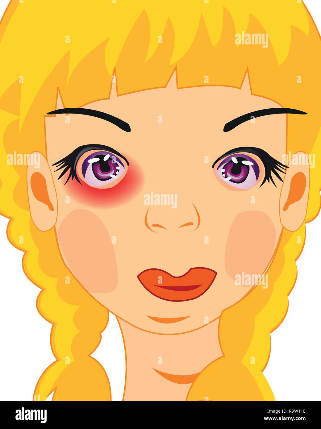 Making look younger girl with bruise under eye Stock Vector Image & Art ...