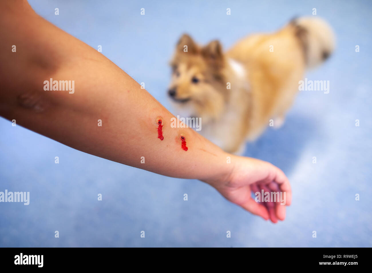 Human aggression hi-res stock photography and images - Alamy