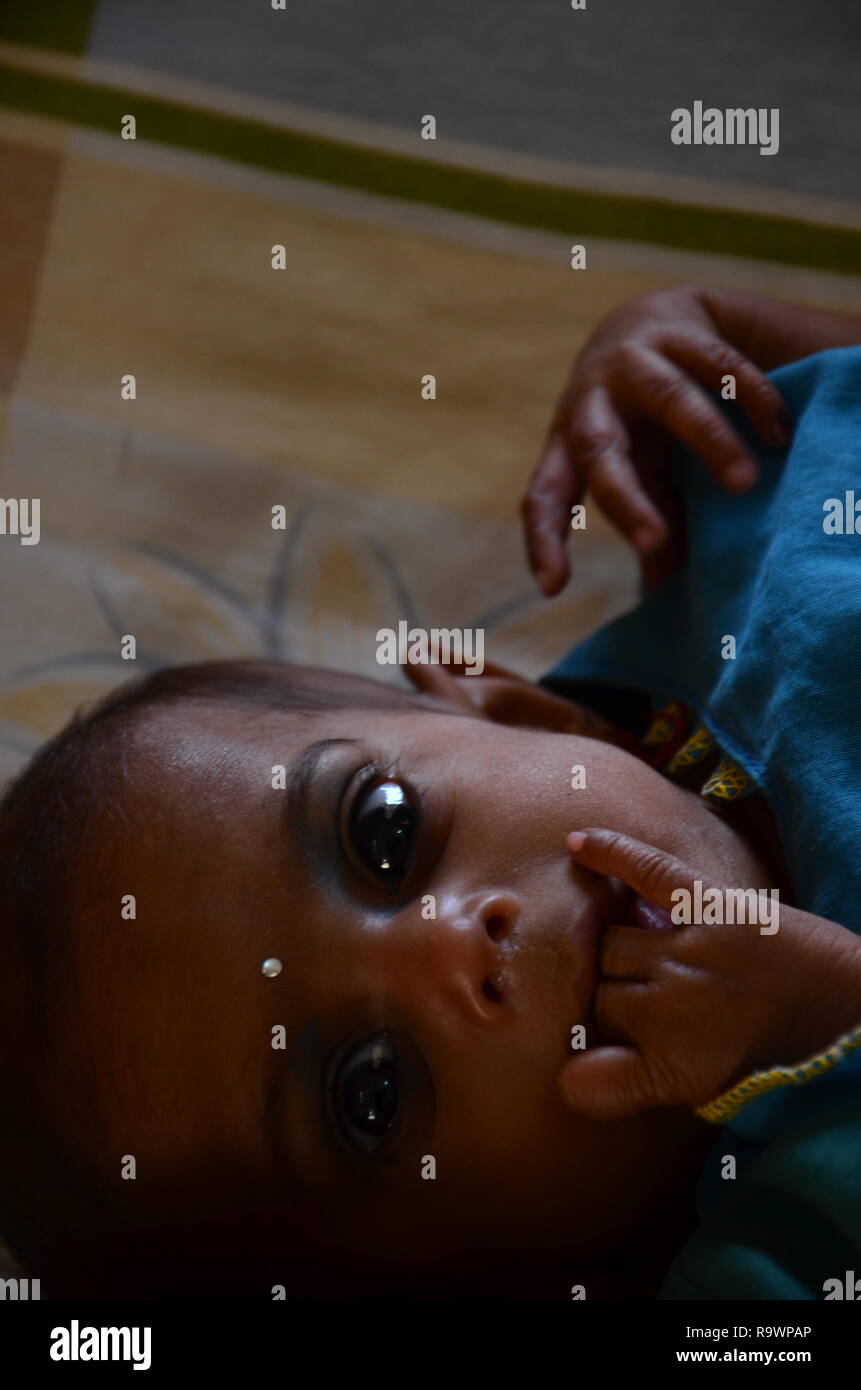 Malnourished Children Stock Photos & Malnourished Children Stock Images ...