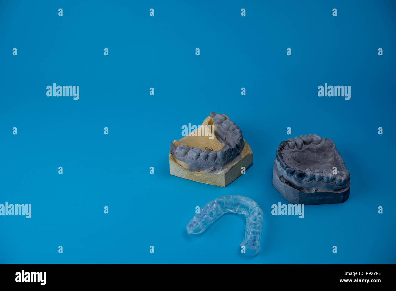 Molds of the jaw. dental splint. Dental implants on blue background ...