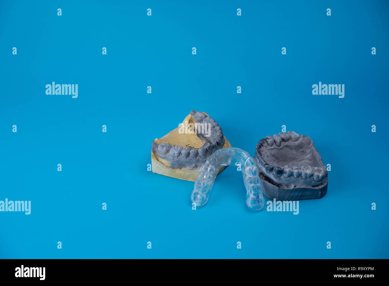 Molds of the jaw. dental splint. Dental implants on blue background ...